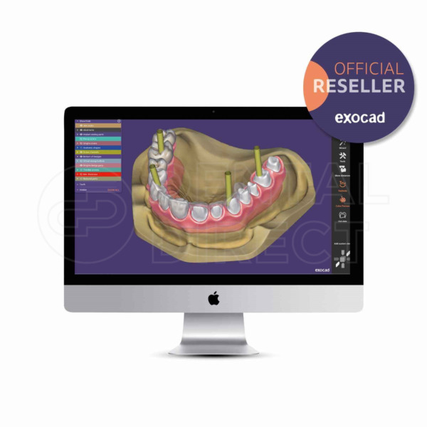Exocad Implant Lab Bundle – rapid și ușor de utilizat - DENTAL DIRECT