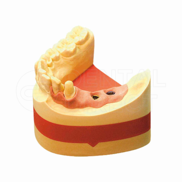 Ghips dentar Picodent Implantat-Rock, ivory, 20kg - DENTAL DIRECT